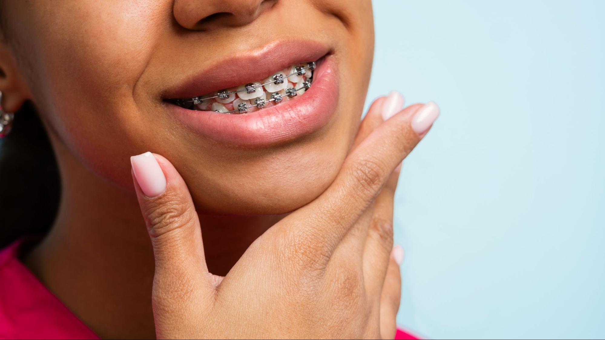 What To Do When Braces Break? | Ollins Orthodontics